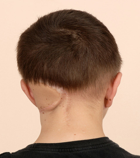 Reconstructive Craniofacial Center | Cleveland Clinic