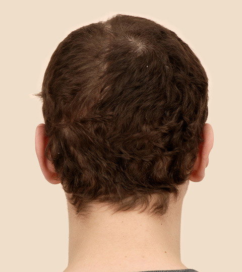 Reconstructive Craniofacial Center | Cleveland Clinic