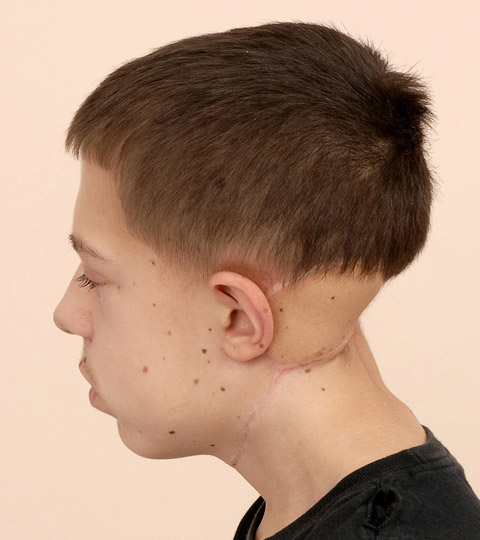 Reconstructive Craniofacial Center | Cleveland Clinic