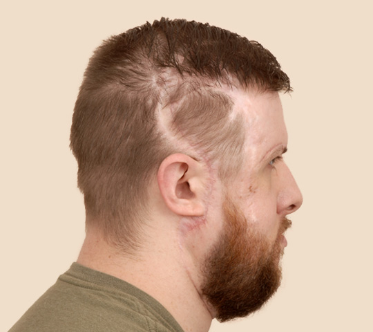 Reconstructive Craniofacial Center | Cleveland Clinic