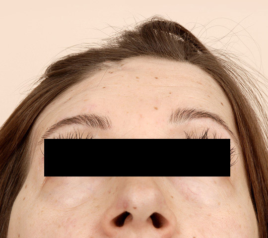 Reconstructive Craniofacial Center | Cleveland Clinic