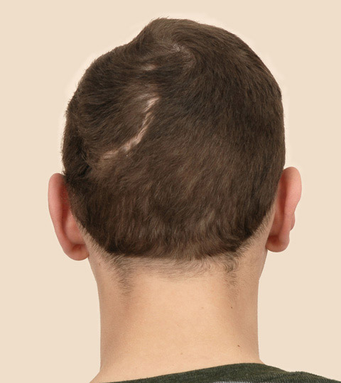 Reconstructive Craniofacial Center | Cleveland Clinic