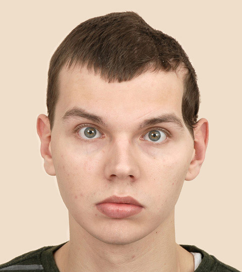 Reconstructive Craniofacial Center | Cleveland Clinic