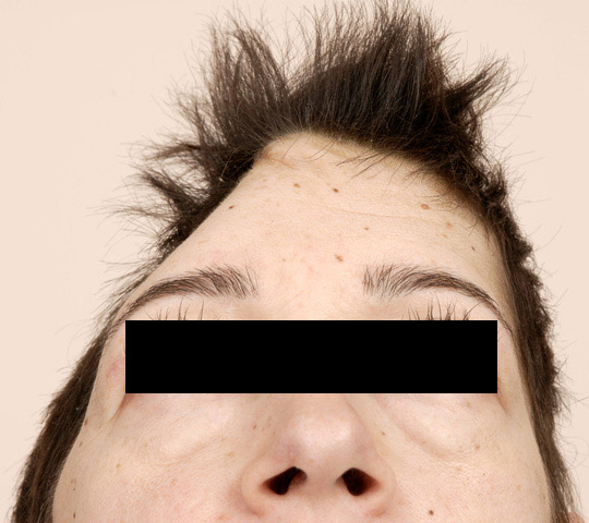 Reconstructive Craniofacial Center | Cleveland Clinic