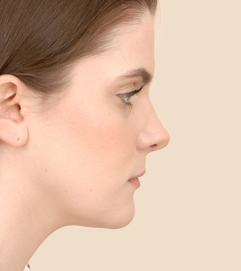Orthognathic Surgery (Jaw Surgery) Program | Cleveland Clinic