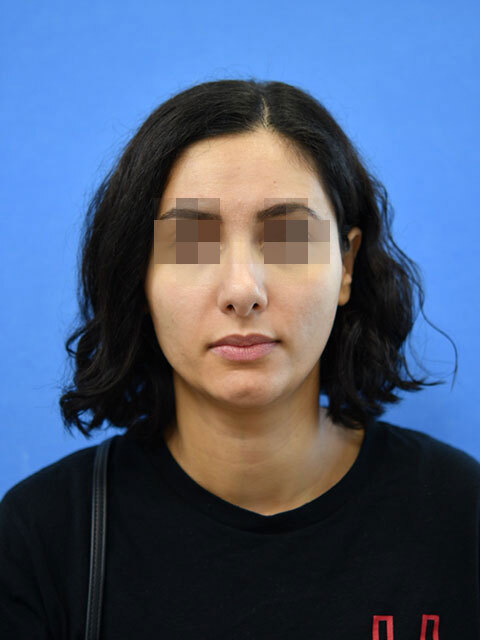 Facial Plastic & Microvascular Surgery | Cleveland Clinic