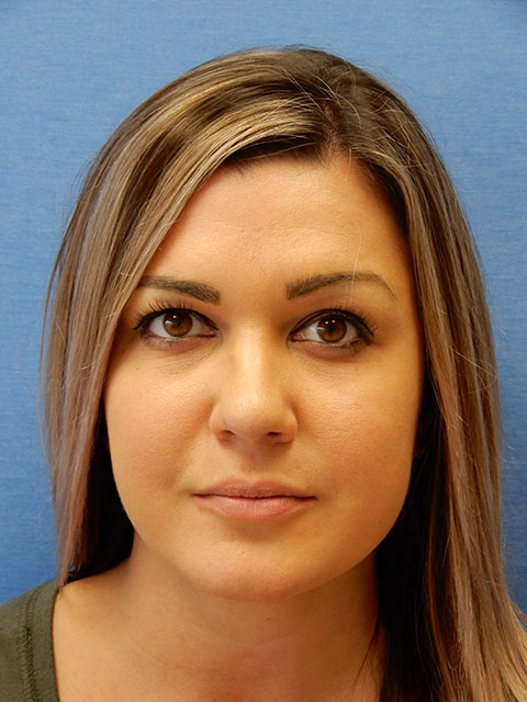 Facial Plastic & Microvascular Surgery | Cleveland Clinic