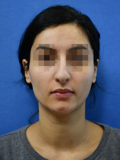 Facial Plastic & Microvascular Surgery | Cleveland Clinic