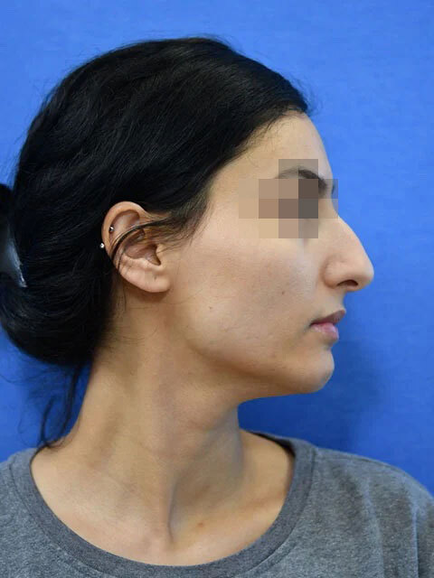 Facial Plastic & Microvascular Surgery | Cleveland Clinic