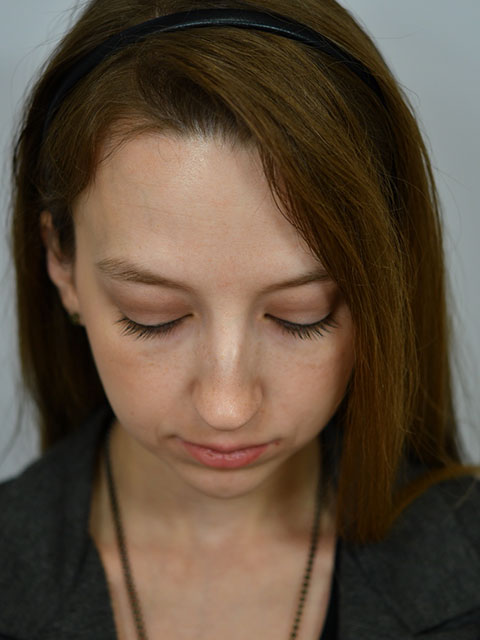 Facial Plastic & Microvascular Surgery | Cleveland Clinic