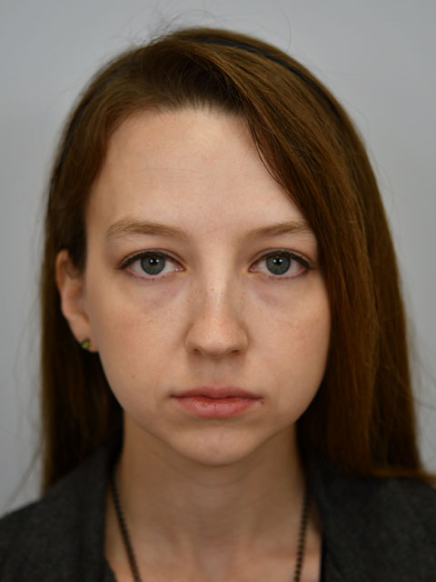 Facial Plastic & Microvascular Surgery | Cleveland Clinic