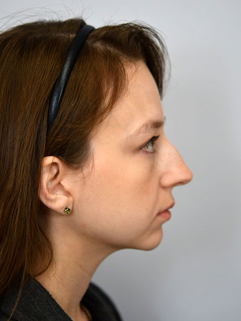 Facial Plastic & Microvascular Surgery | Cleveland Clinic