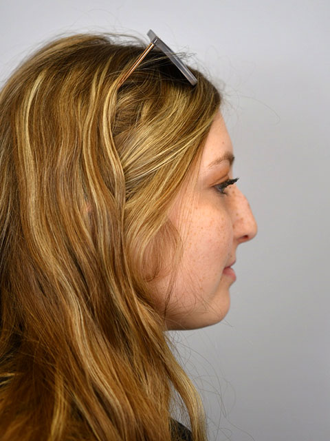 Facial Plastic & Microvascular Surgery | Cleveland Clinic