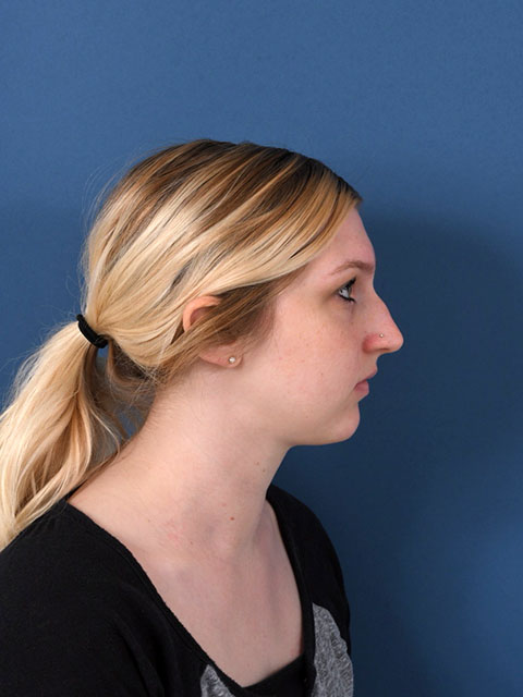 Facial Plastic & Microvascular Surgery | Cleveland Clinic