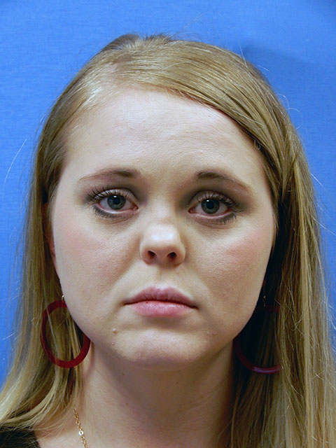 Facial Plastic & Microvascular Surgery | Cleveland Clinic