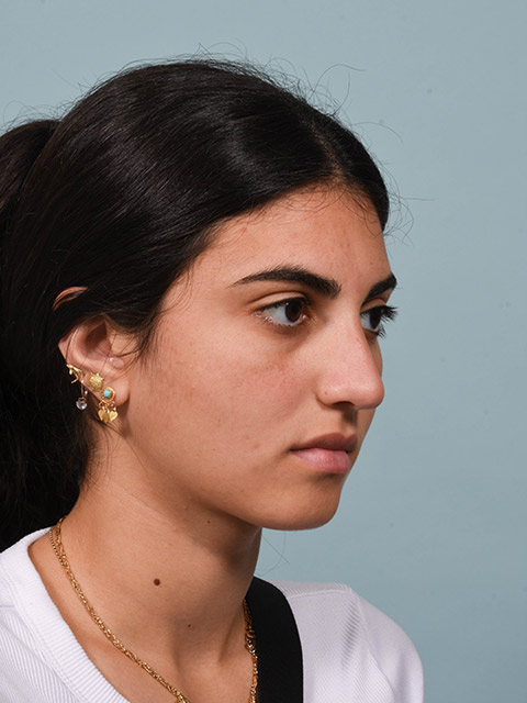 Facial Plastic & Microvascular Surgery | Cleveland Clinic