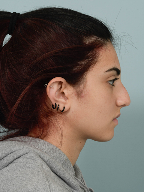 Facial Plastic & Microvascular Surgery | Cleveland Clinic