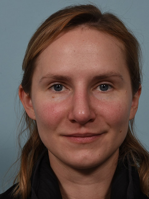 Facial Plastic & Microvascular Surgery | Cleveland Clinic