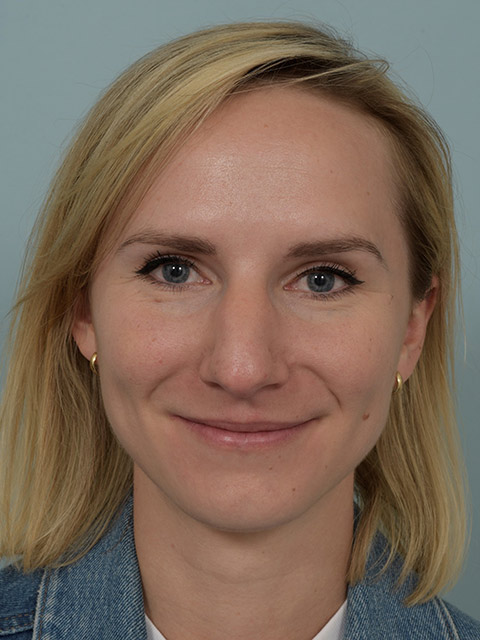 Facial Plastic & Microvascular Surgery | Cleveland Clinic