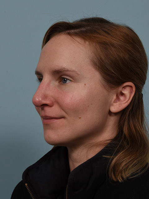 Facial Plastic & Microvascular Surgery | Cleveland Clinic