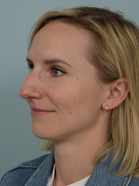 Facial Plastic & Microvascular Surgery | Cleveland Clinic