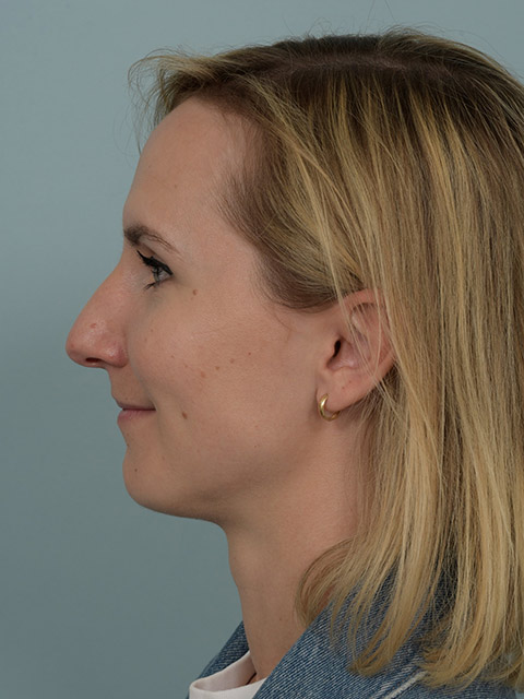 Facial Plastic & Microvascular Surgery | Cleveland Clinic