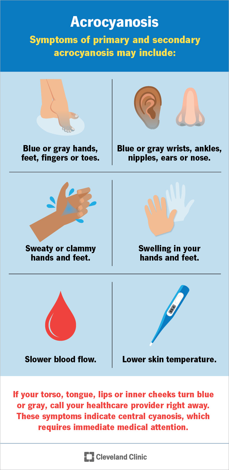 Causes Of Cold Hands And Feet In Baby Ways To Deal 58 OFF Causes Of Cold Hands And Feet In Baby Ways To Deal 58 OFF