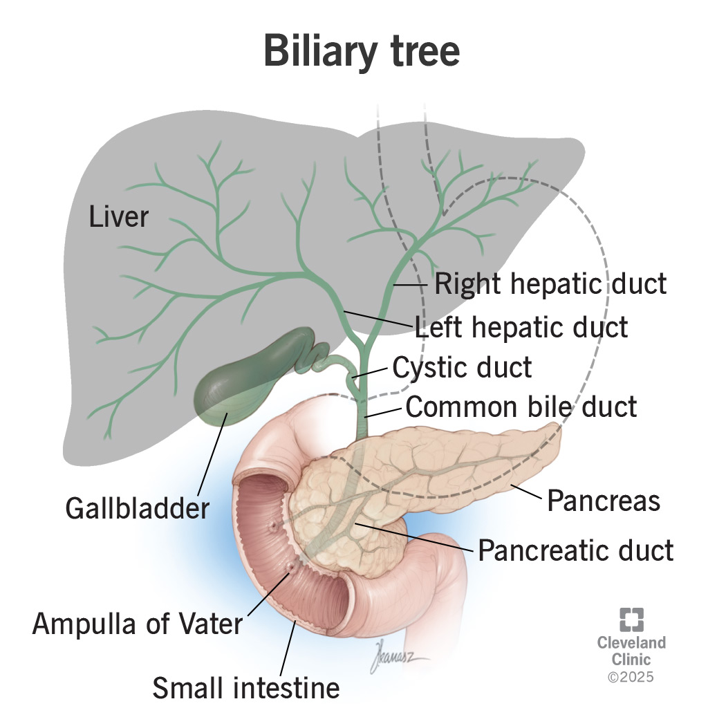 Biliary Aetiology Biliary Aetiology