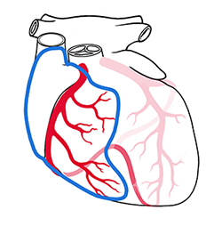 Heart Attack (Myocardial Infarction) – GenerX