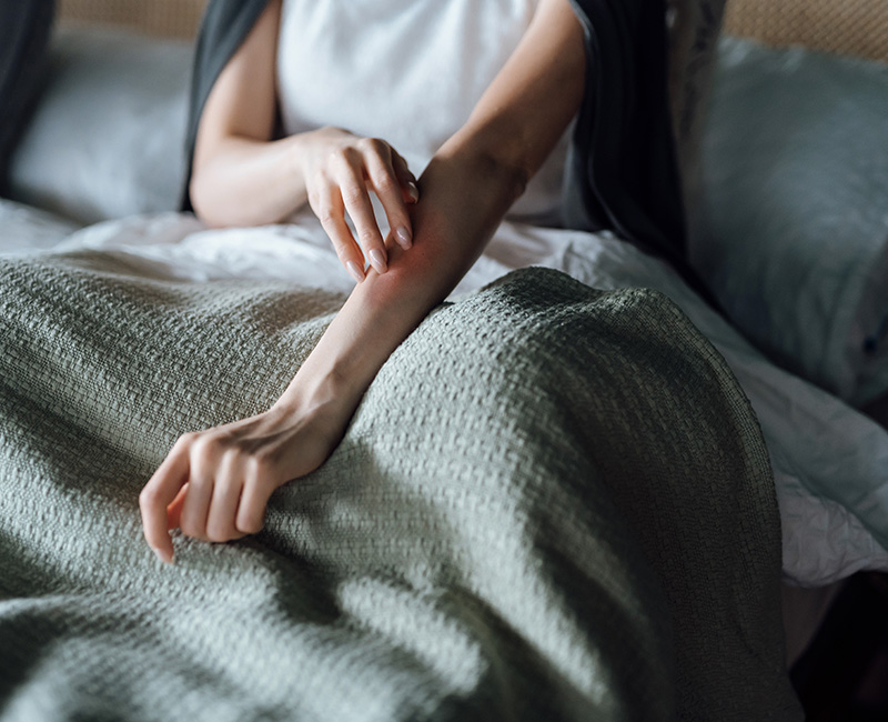What to Know About Systemic Mastocystosis