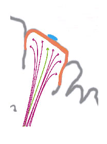 Epilepsy Center | Cleveland Clinic