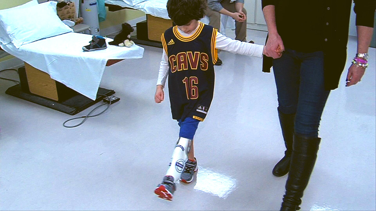 Rare Surgery After Cancer Saves Young Boy’s Leg | Bone Cancer Patient Story