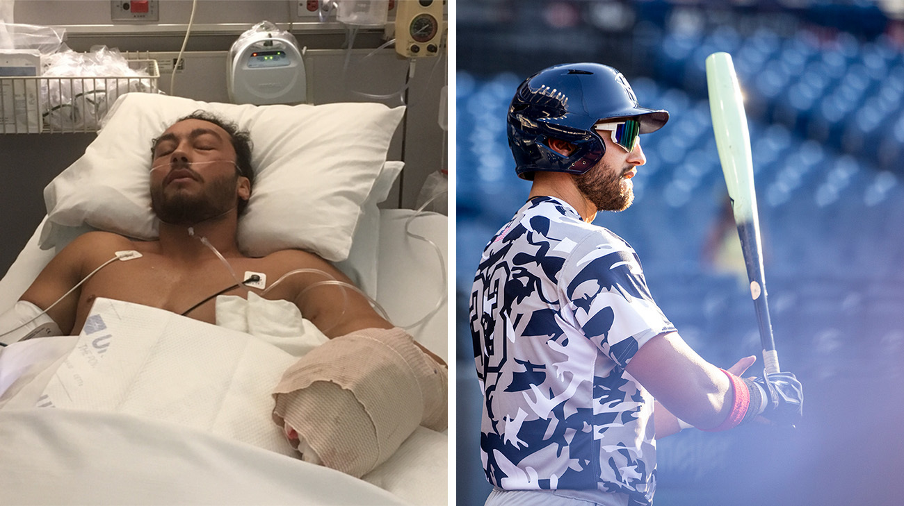 Baseball Player Throws Again After Losing Hand in Lawnmower Accident