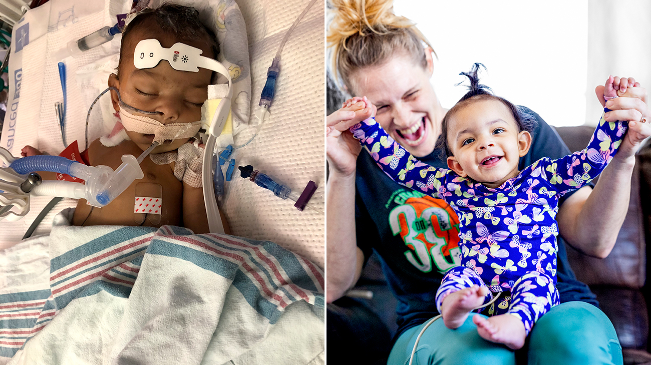 Heart Transplant Saves Infant With Enlarged Heart