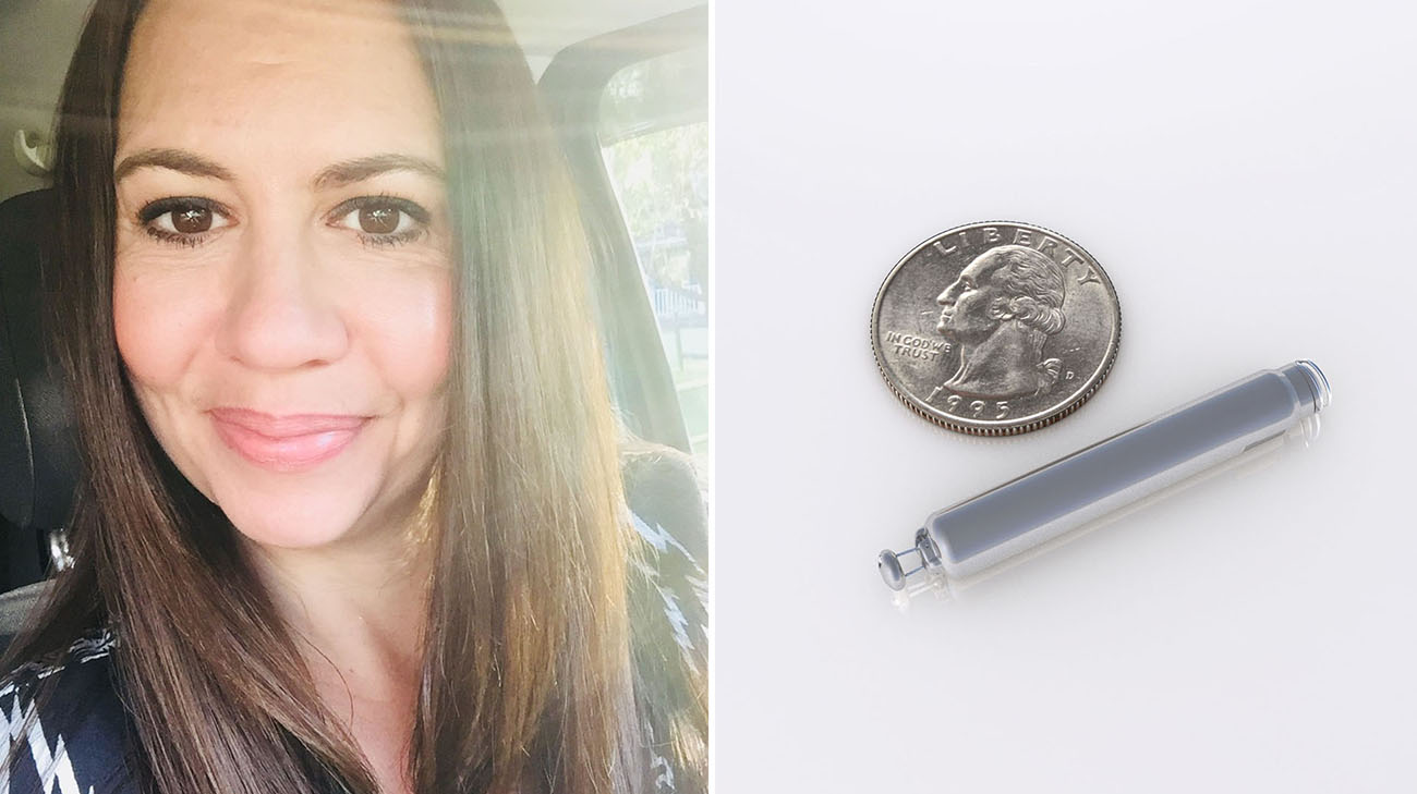 Kara Reamer: (LCP) Pacemaker Patient Story | Cleveland Clinic