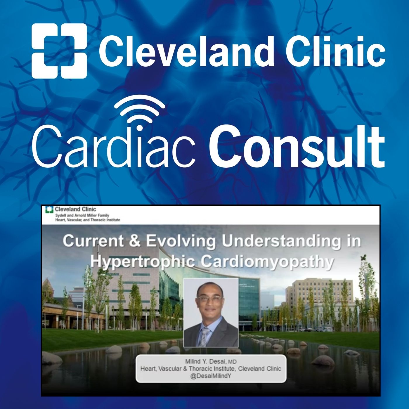 Current & Evolving Understanding in Hypertrophic Cardiomyopathy ...