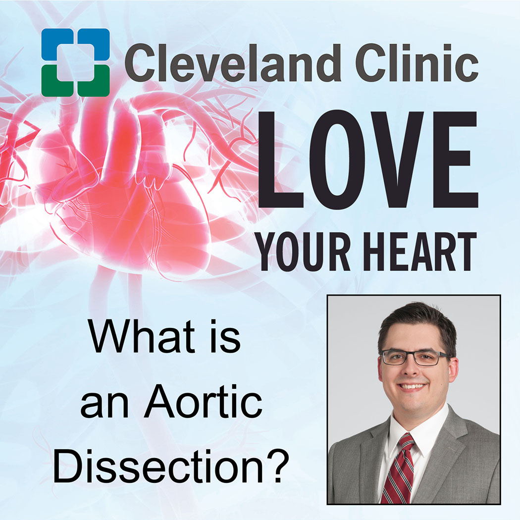 What is an Aortic Dissection? | Cleveland Clinic